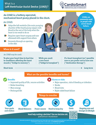 Lvad What Is A Left Ventricular Assist Device Infographic