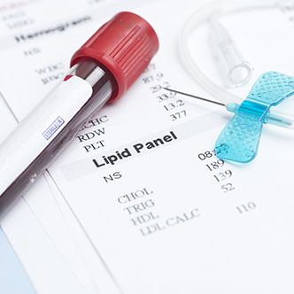 A New Improved Method for Cholesterol Tests | CardioSmart – American ...